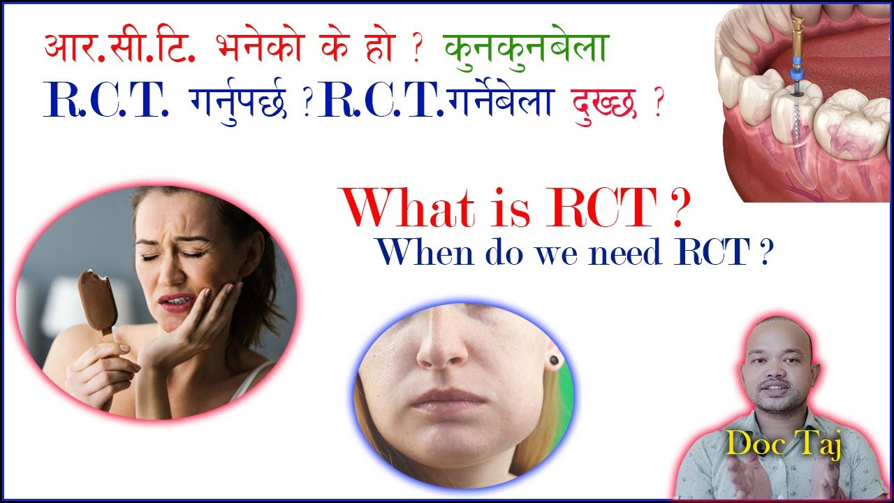 What is RCT?/ Root Canal Treatment/आर सि टि भनेको के हो/ Indications ...