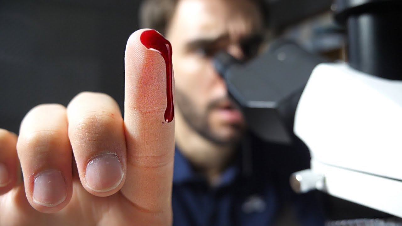 JE VOUS MONTRE MON SANG AU MICROSCOPE ! - YouTube