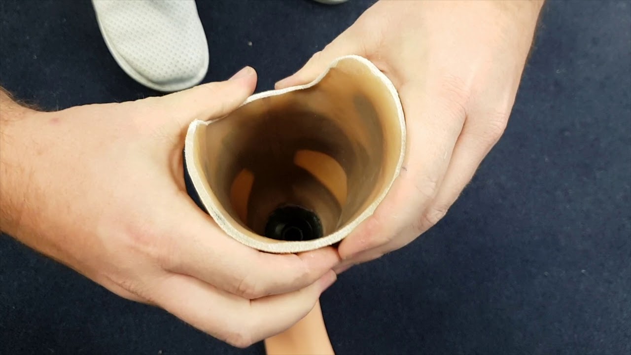 Below knee amputee with flexible Protheflex socket! MAXIMUM COMFORT ...