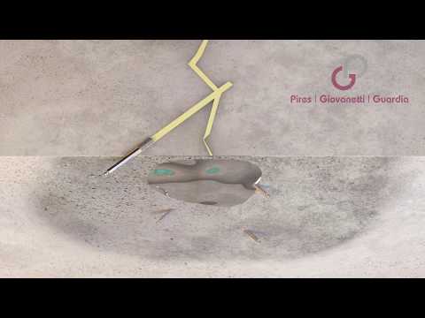 Pires | Giovanetti | Guardia - Inyección de poliuretano en fisuras de juntas de concretaje