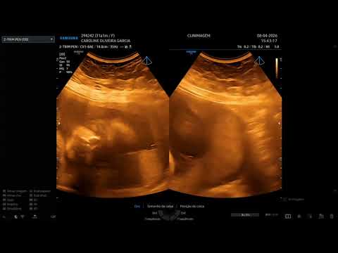 Ultrassom 27 semanas baby Olivia❤️