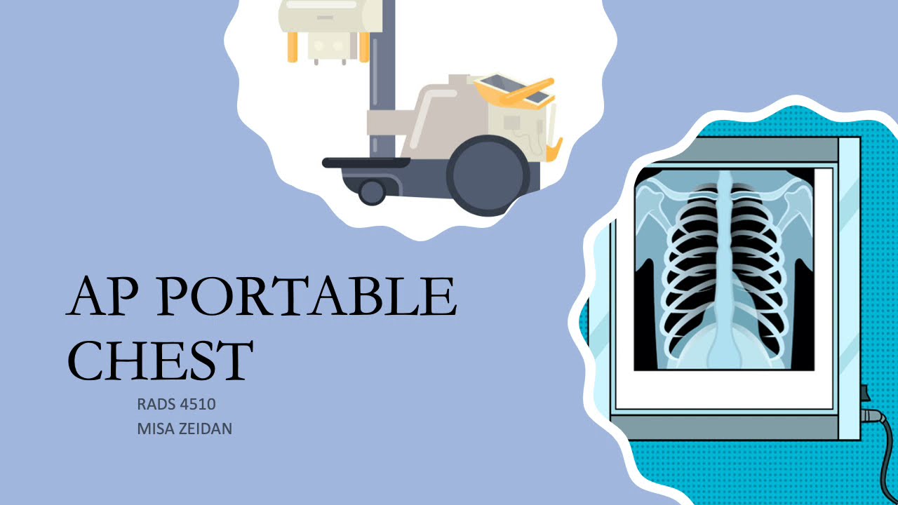 AP Portable Chest Analysis - YouTube