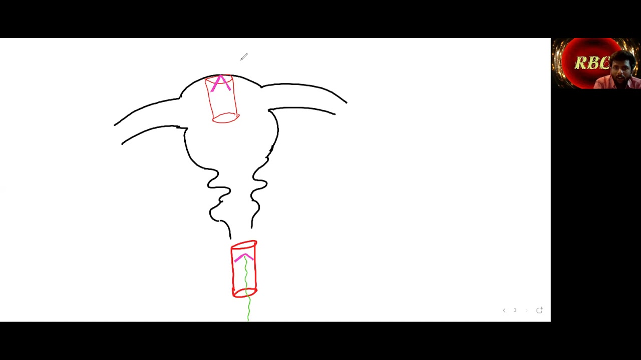 26 November2021 L-2 [Hormonal Contraceptive method=Action of Saheli ...