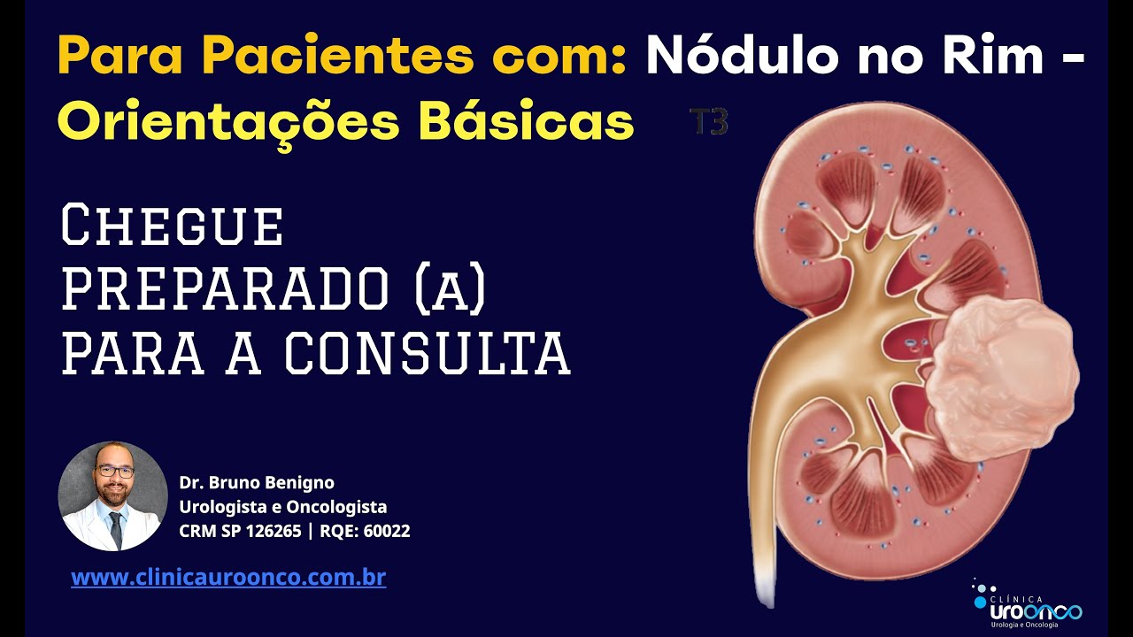 Tenho um Nódulo no Rim | prepare-se para sua consulta | Informações ...