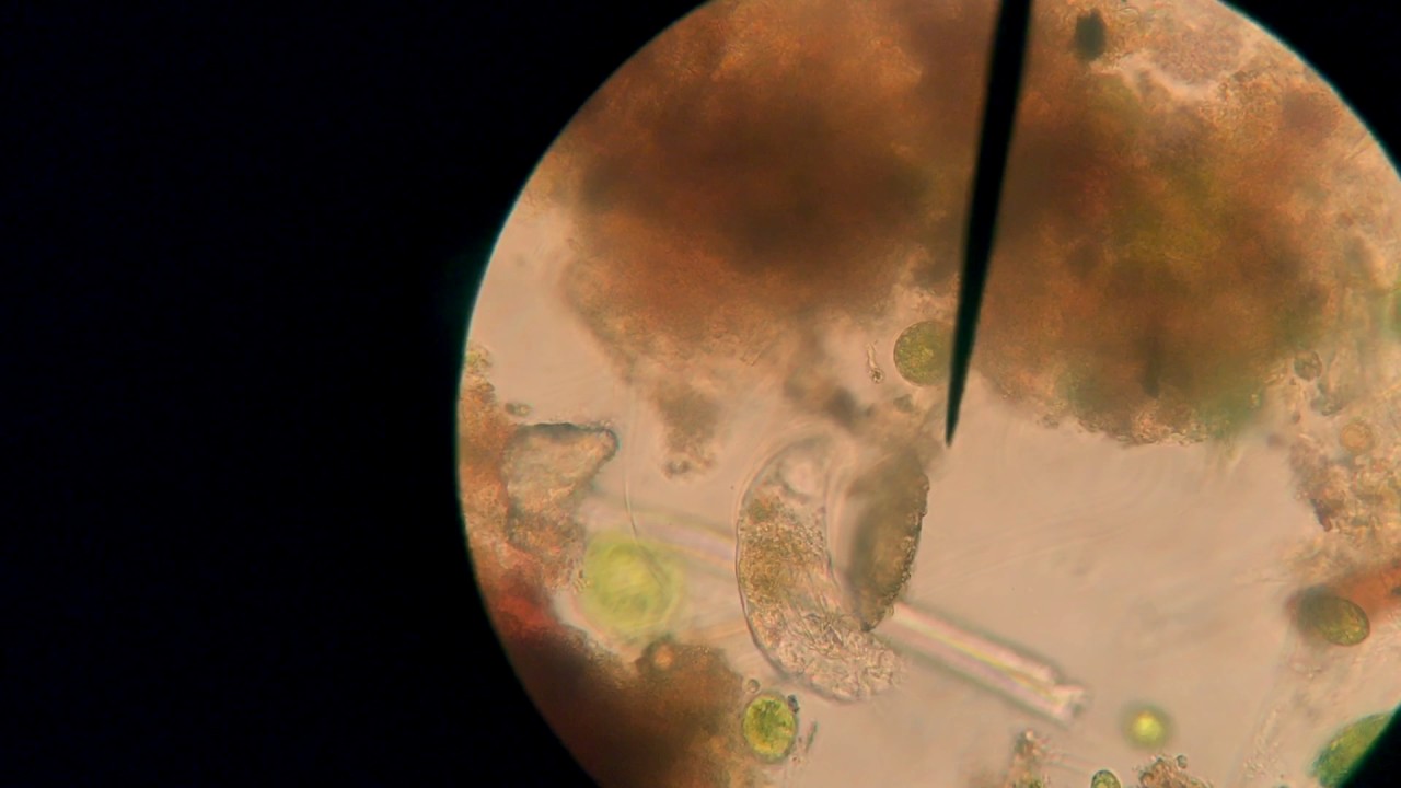 Microscopic Life- The Pond - YouTube