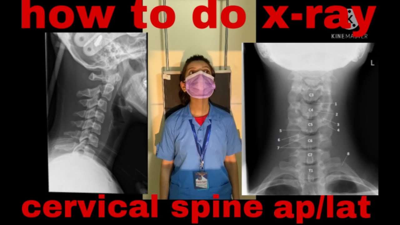 How To Do X-ray Cervial Spine AP LAT - YouTube