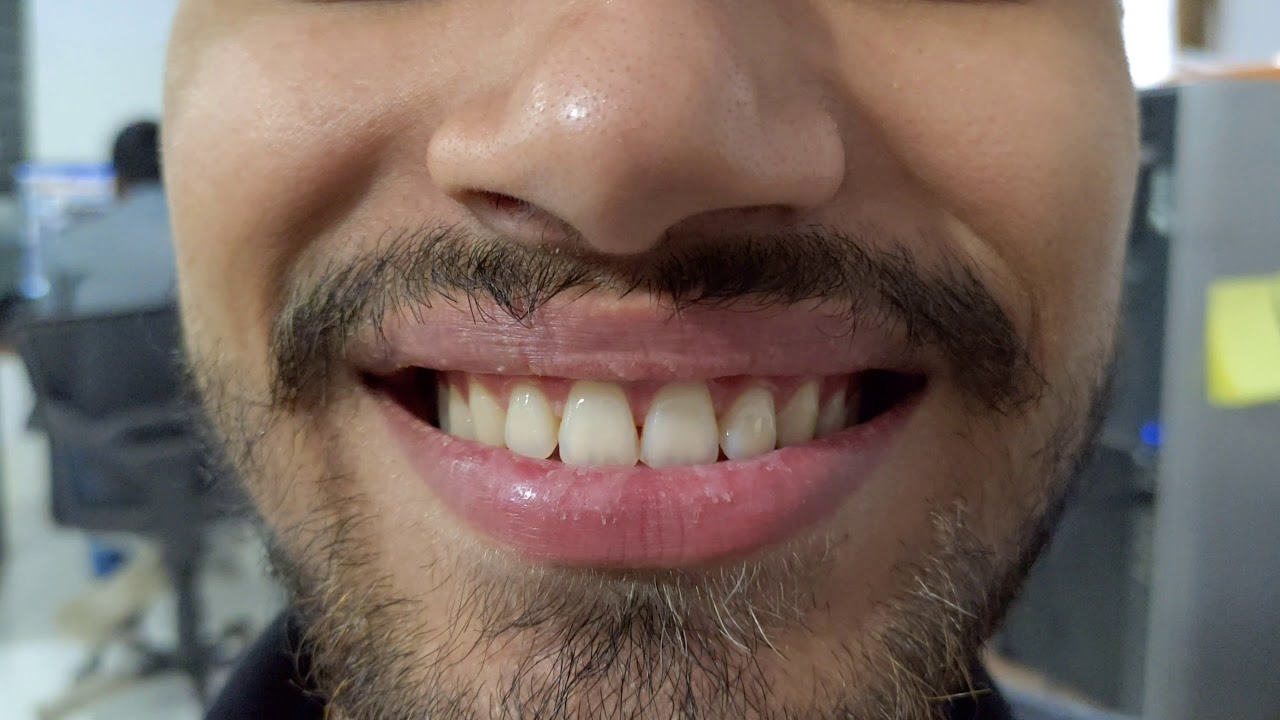 Smile animation reference - YouTube