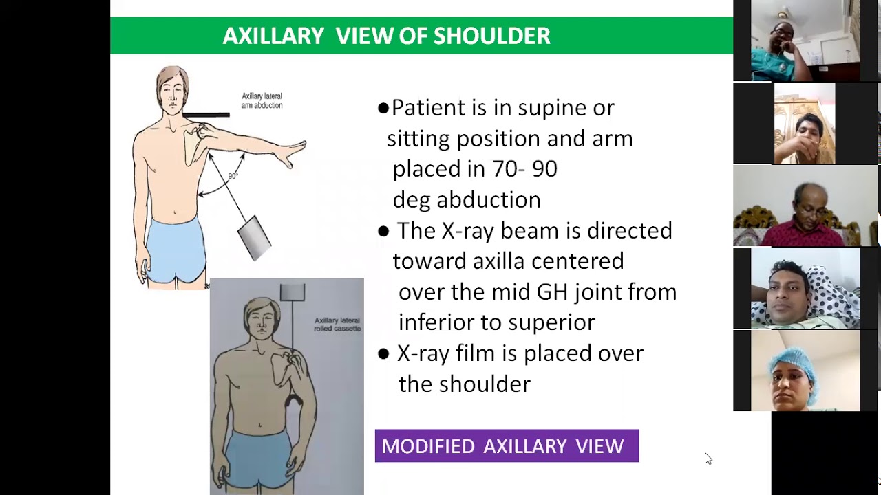 Shoulder X-Ray : What I Know From It - YouTube
