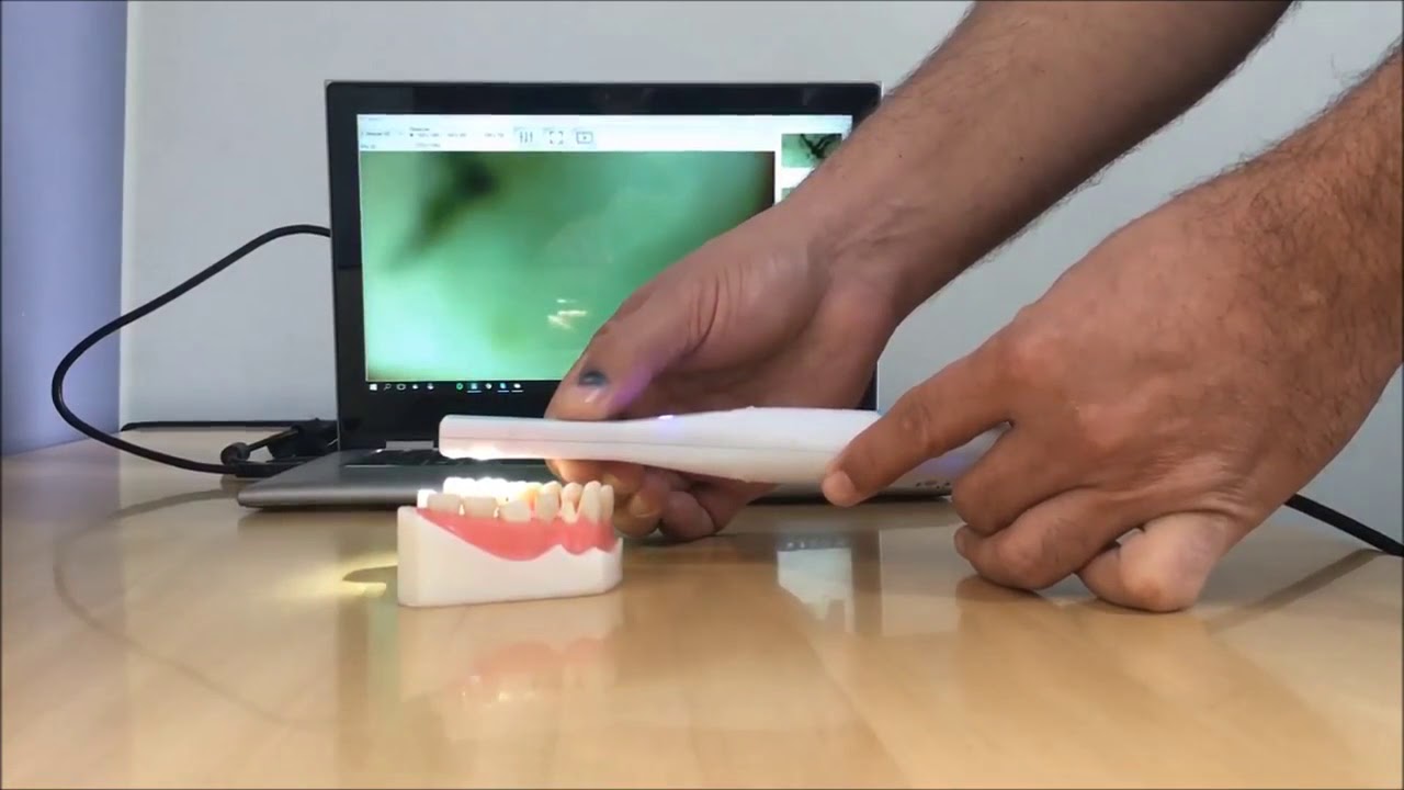 Captura Macro - IntraCam - Câmera Intra/extraoral - YouTube