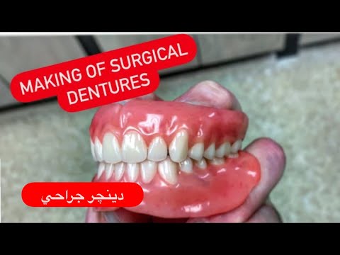 Making of immediate dentures (surgical) from impression to delivery # ...