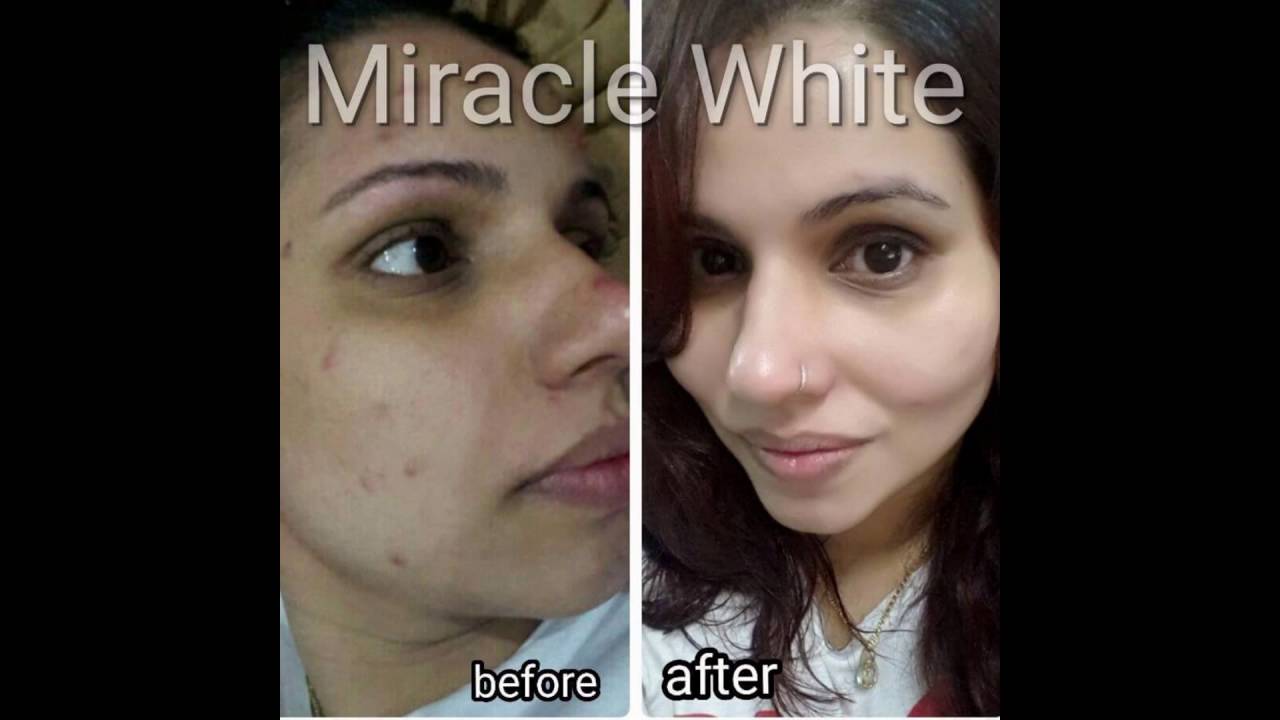 Miracle White - YouTube