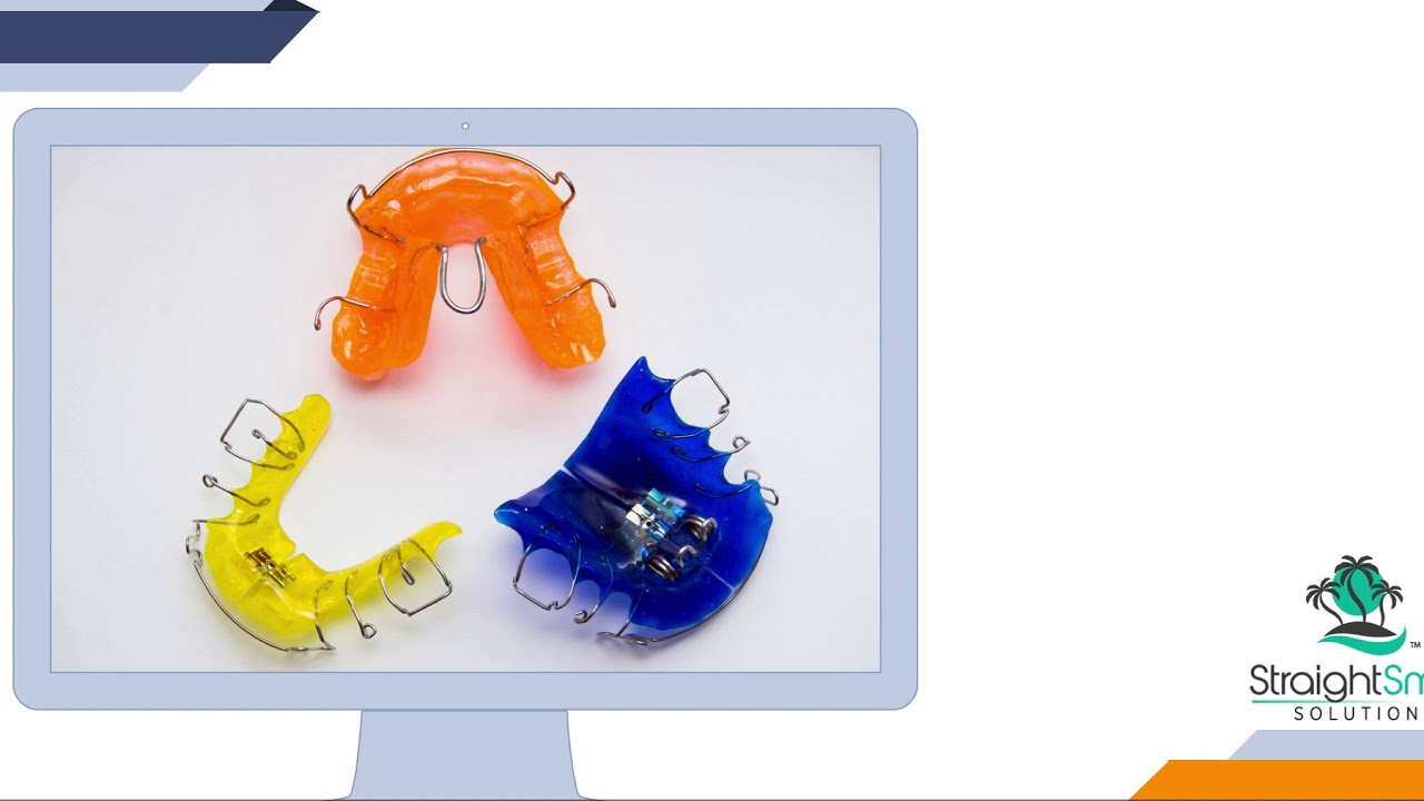 RPE, Palatal Expansion in a Phase 1 Patient https://www ...