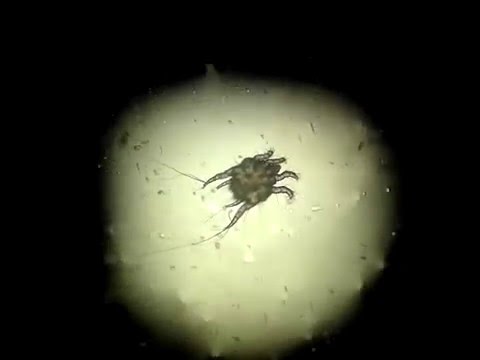 ear mite under the microscope - YouTube