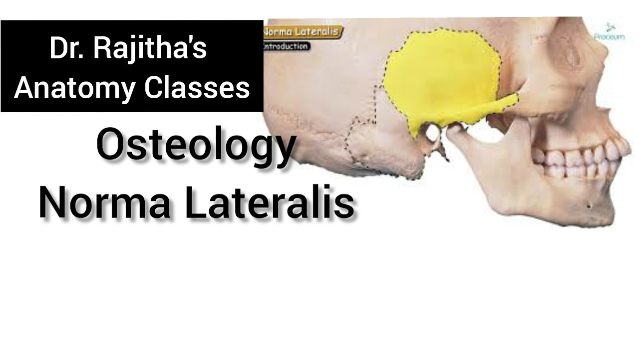 Osteology of Norma Lateralis/ Norma Temporalis by Dr. Rajitha Vanga ...