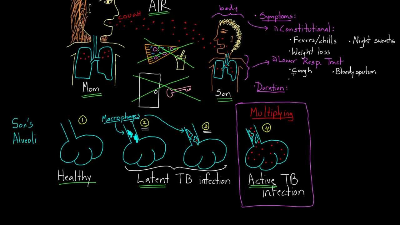 Symptoms and Spread of Tuberculosis - YouTube
