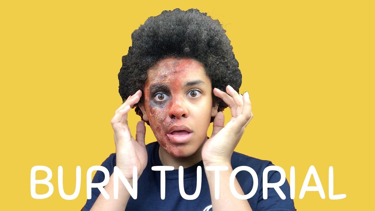 BURN VICTIM SFX MAKEUP TUTORIAL! - YouTube