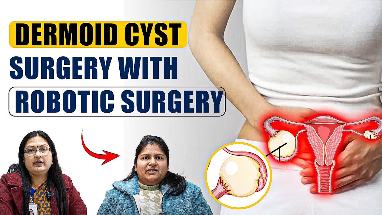Australia To Apollo Hospital Delhi : Dermoid Cyst Surgery By Dr. Pakhee ...