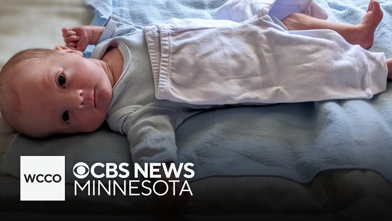 Minnesota baby born early in Brazil is now stuck there, parents say ...