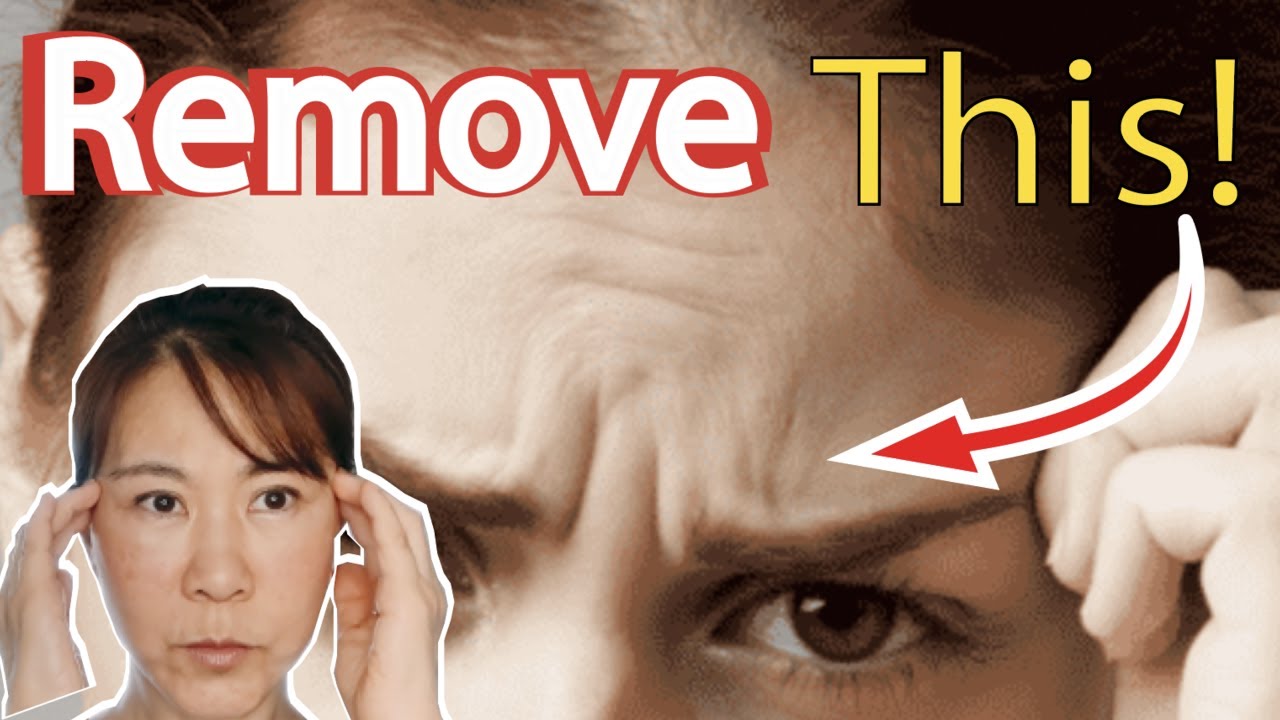 Rid of Frown Lines without Botox!🔥 Remove Forehead Wrinkles and 11 ...