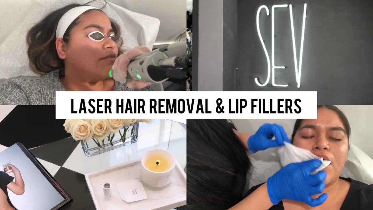 I WENT TO SEV LASER AND THIS HAPPENED.... | JewellTV - YouTube