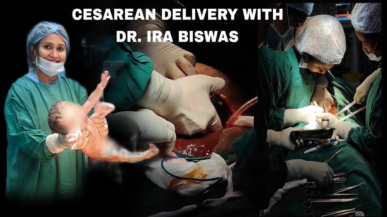 Steps of a Cesarean delivery - YouTube
