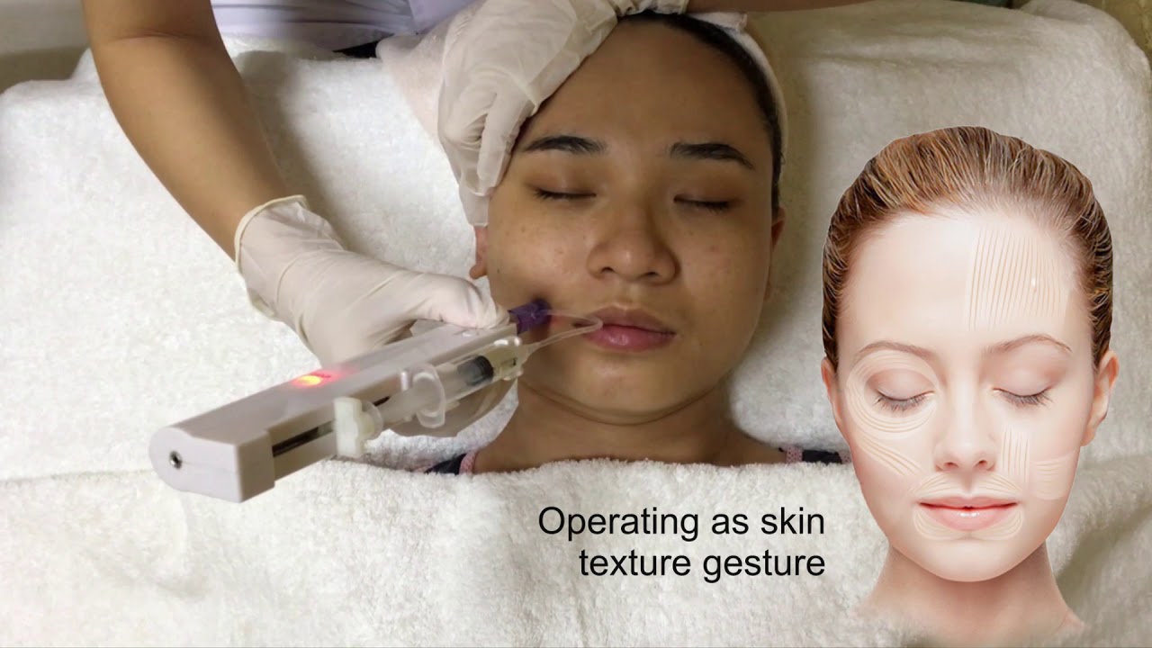 Microneedling pen used to treat skin concerns via collagen production ...