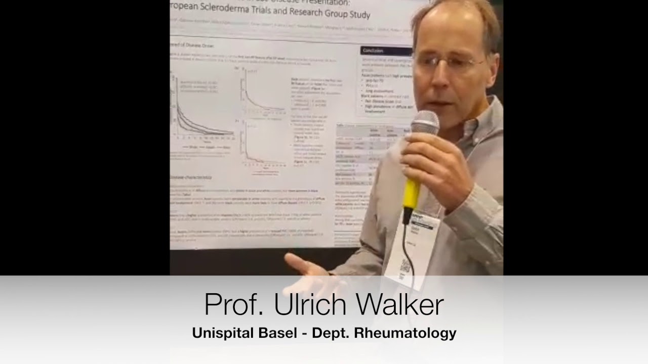 Prof. Ulrich Walker interviewed at ACR18 on racial differences in SSc ...