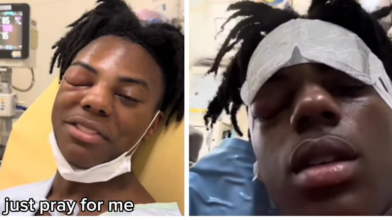 ishowSpeed accident updates| speed accident| how is speed - YouTube