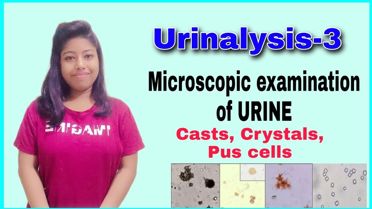 Urine Microscopy , Microscopic examination of Urine, Urinalysis-3 - YouTube