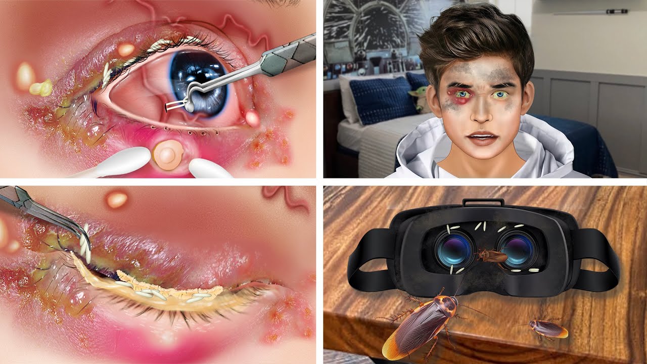 Why It's Bad When Cockroaches Crawl Into Your Eye, Deep Cleaning ...