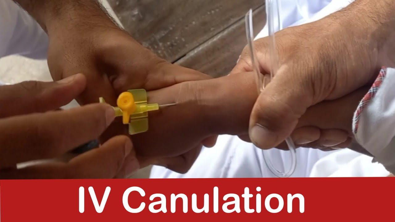 iv cannulation technique | iv cannula lagane ka tarika | iv cannula for ...