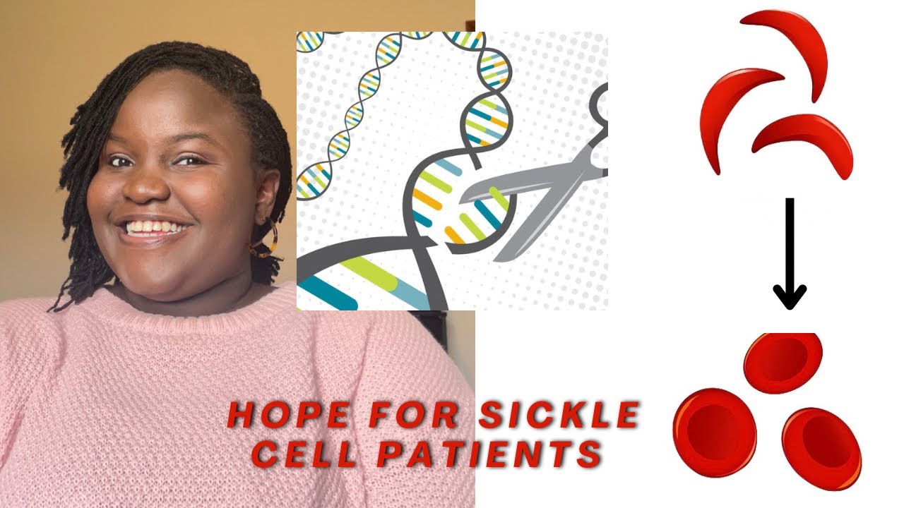SCIENCE SIMPLIFIED: HOW THE NEWLY FDA APPROVED SICKLE CELL TREATMENT ...