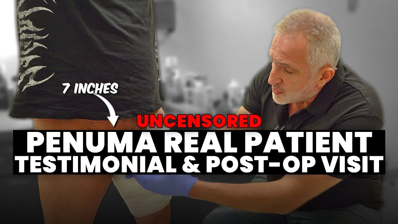 7 INCHES! X-Large Penuma Himplant™ Implant Review | Real Patient’s ...