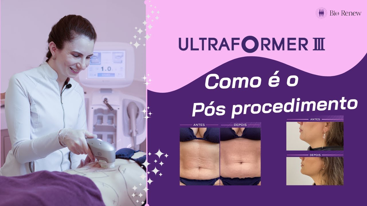 ULTRAFORMER : Como é o pós-procedimento com o ultraformer | Bio renew ...