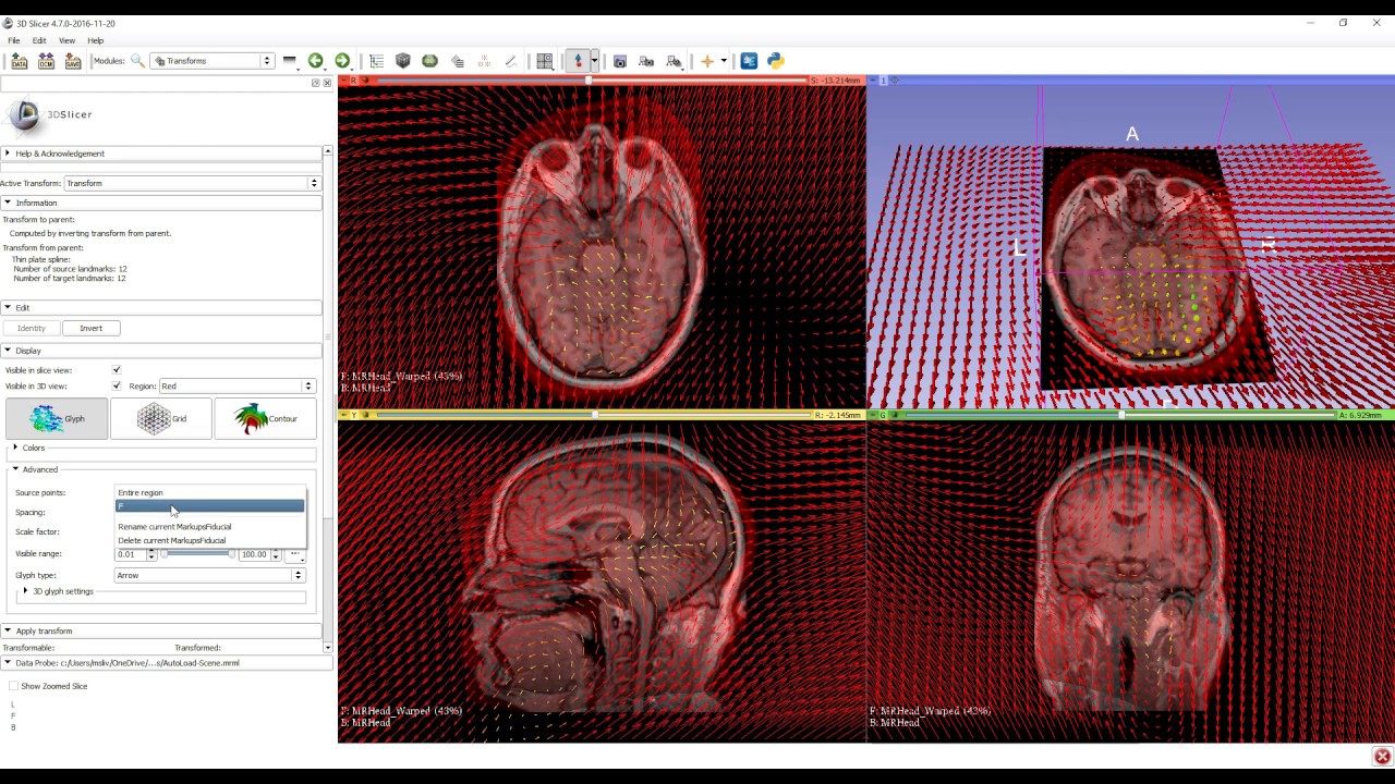 Visualizing point displacements using 3D Slicer - YouTube