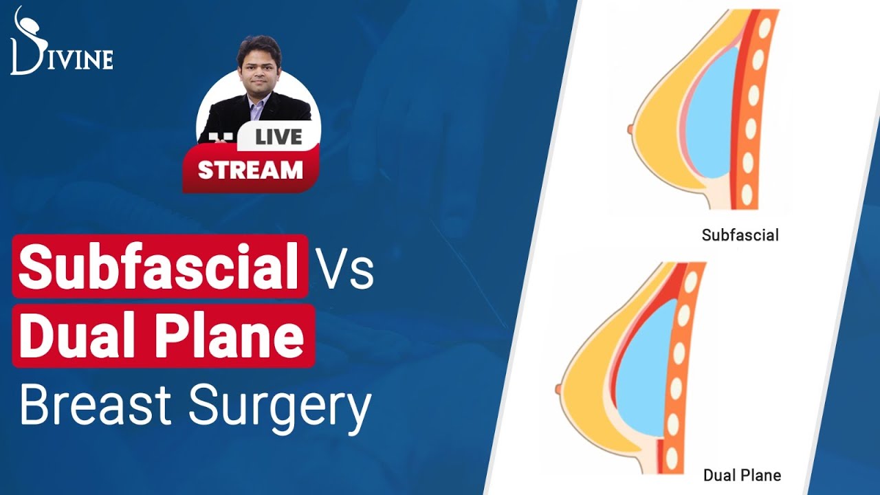 Difference Between Subfascial And Dual Plane Breast Surgery - YouTube