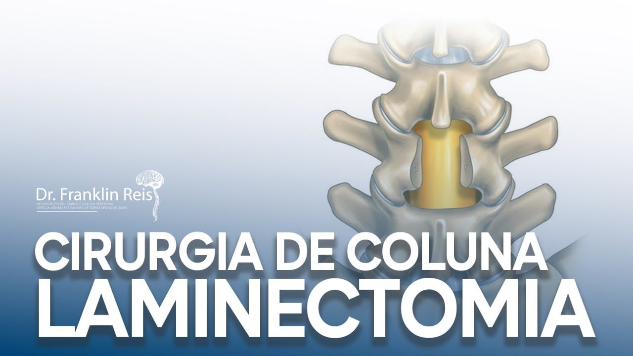 Cirurgia de Coluna Laminectomia - YouTube