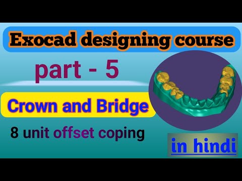 Exocad Video Tutorial Introduction to Basic Features Offset Coping ...
