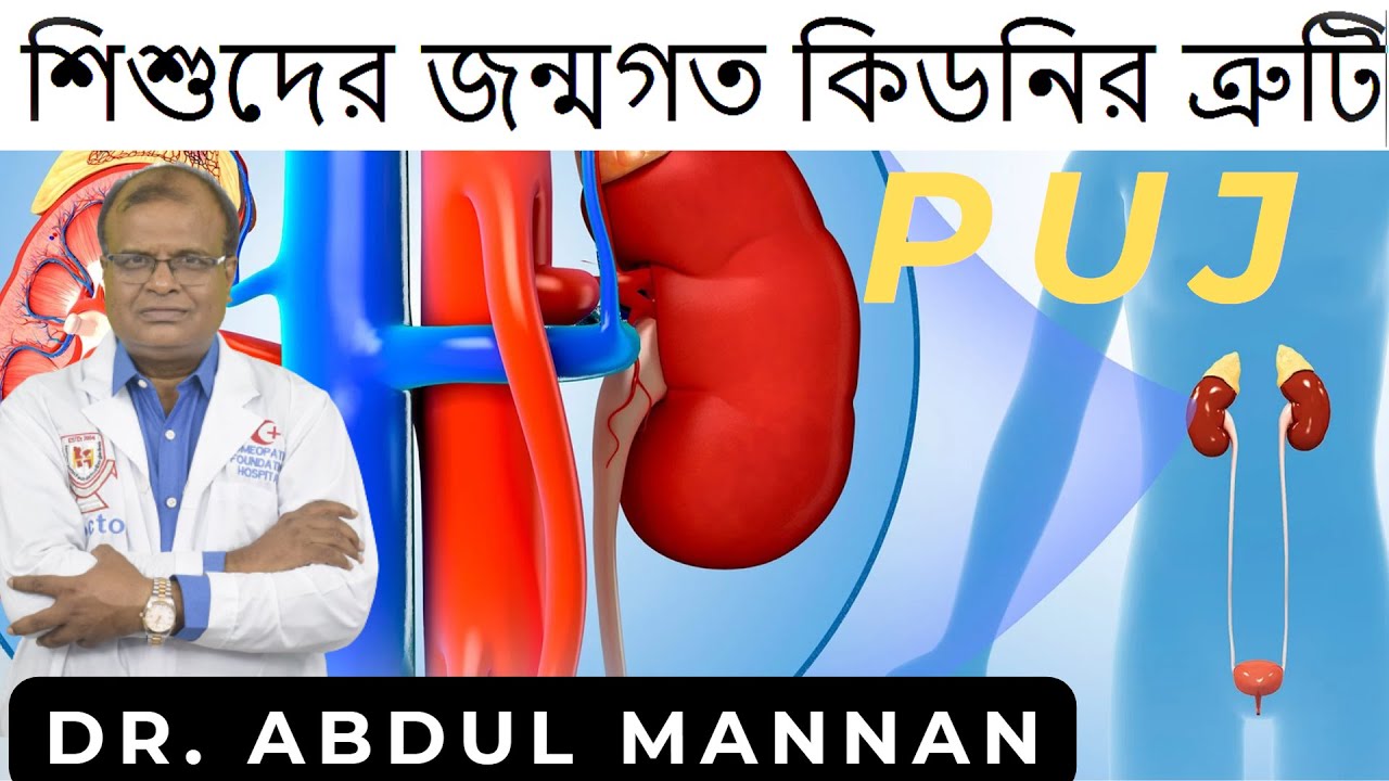 শিশুদের জন্মগত কিডনির ত্রুটি - PUJ ( Pelvic Uteric Junction Obstruction ...