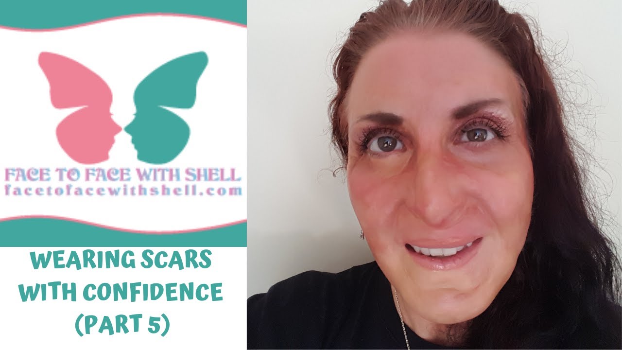WEARING SCARS WITH CONFIDENCE (PART 5) - YouTube