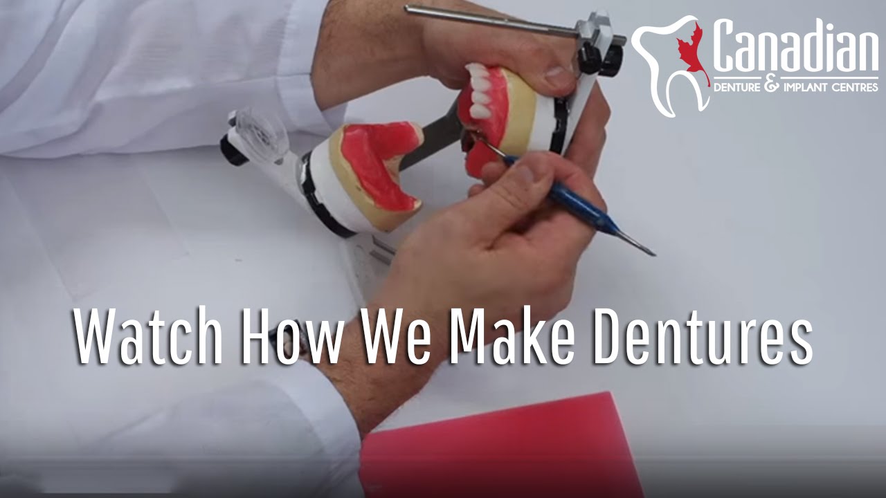 How Dentures Are Made – Time lapse By Canadian Denture Centres Calgary ...