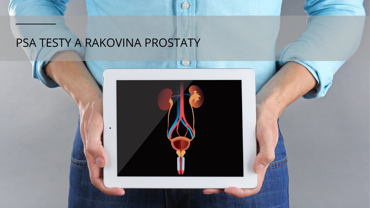 PSA testy a rakovina prostaty I MUDr. Szeiff I Movember - YouTube