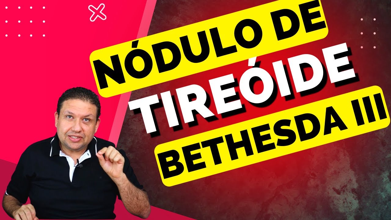 NÓDULO DE TIREÓIDE INDETERMINADO, BETHESDA 3, NÓDULO DE TIREÓIDE TIPO ...