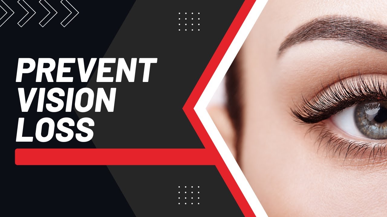 5 Proven Ways To Keep Your Eyes Healthy And Prevent Vision Loss - YouTube