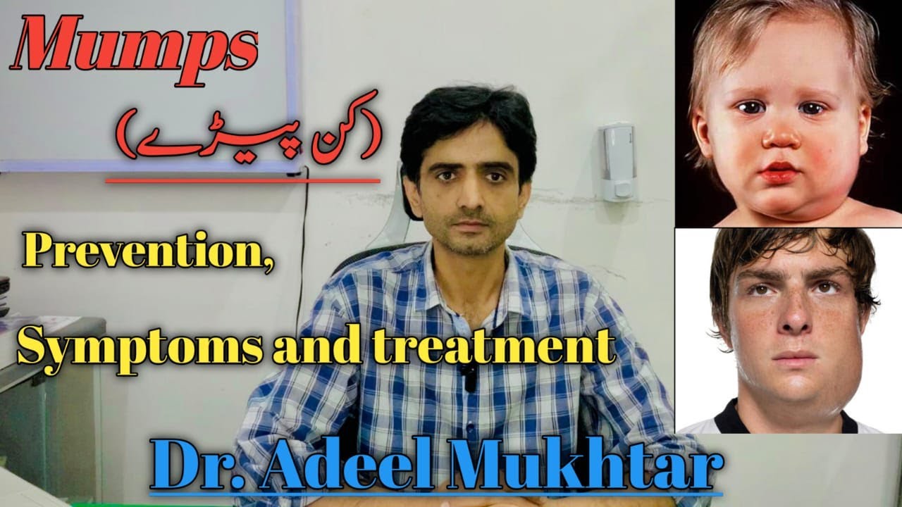 MUMPS CAUSES, SYMPTOMS, TREATMENT AND PREVENTIONS - YouTube