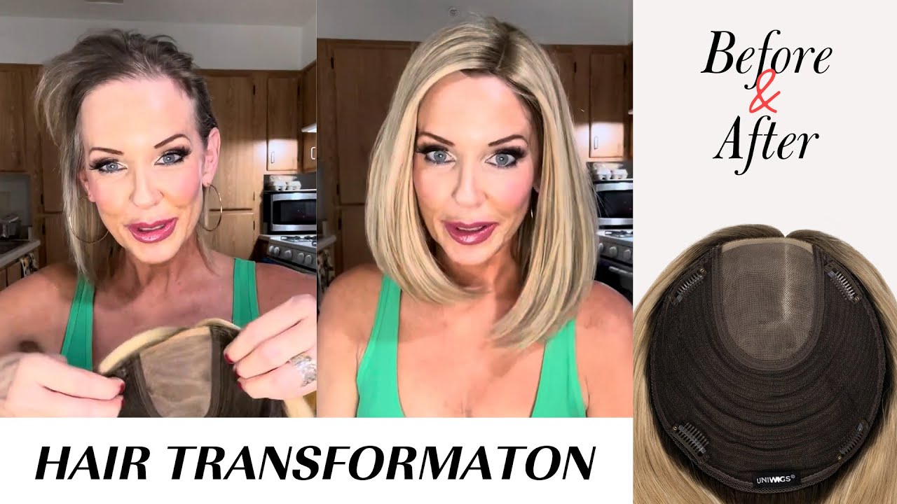 14 Years, I Finally Find a Way to Solve Hair Loss | Upgrade Courtney ...