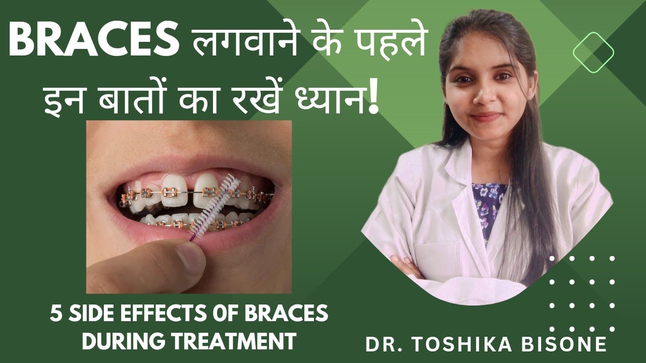 Side effects of Braces | How to maintain braces treatment | Orthodontic ...
