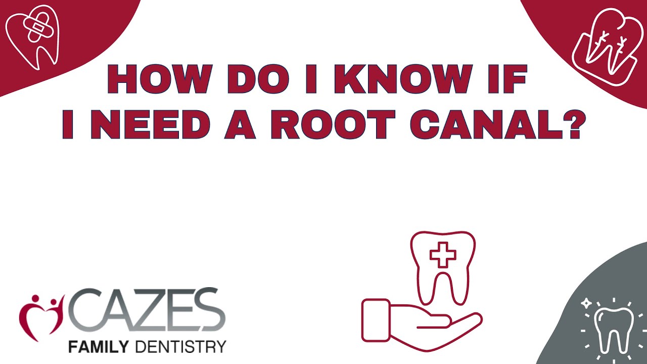 Cazes Family Dentistry - How Do I Know if I Need a Root Canal? - YouTube
