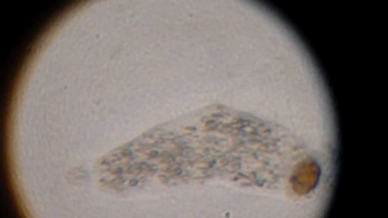 Amoeba 400x Magnification