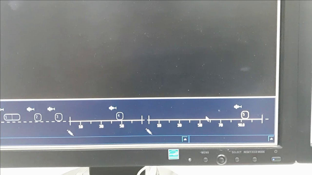필립스 CT 하나의 scout 으로 2개 이상의 검사를 하는방법 manual timed bolus tracking 설정방법 ...